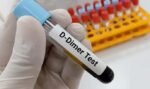 D-dimer Blood Test: Purpose, Procedure, and High-Level Indicators ...