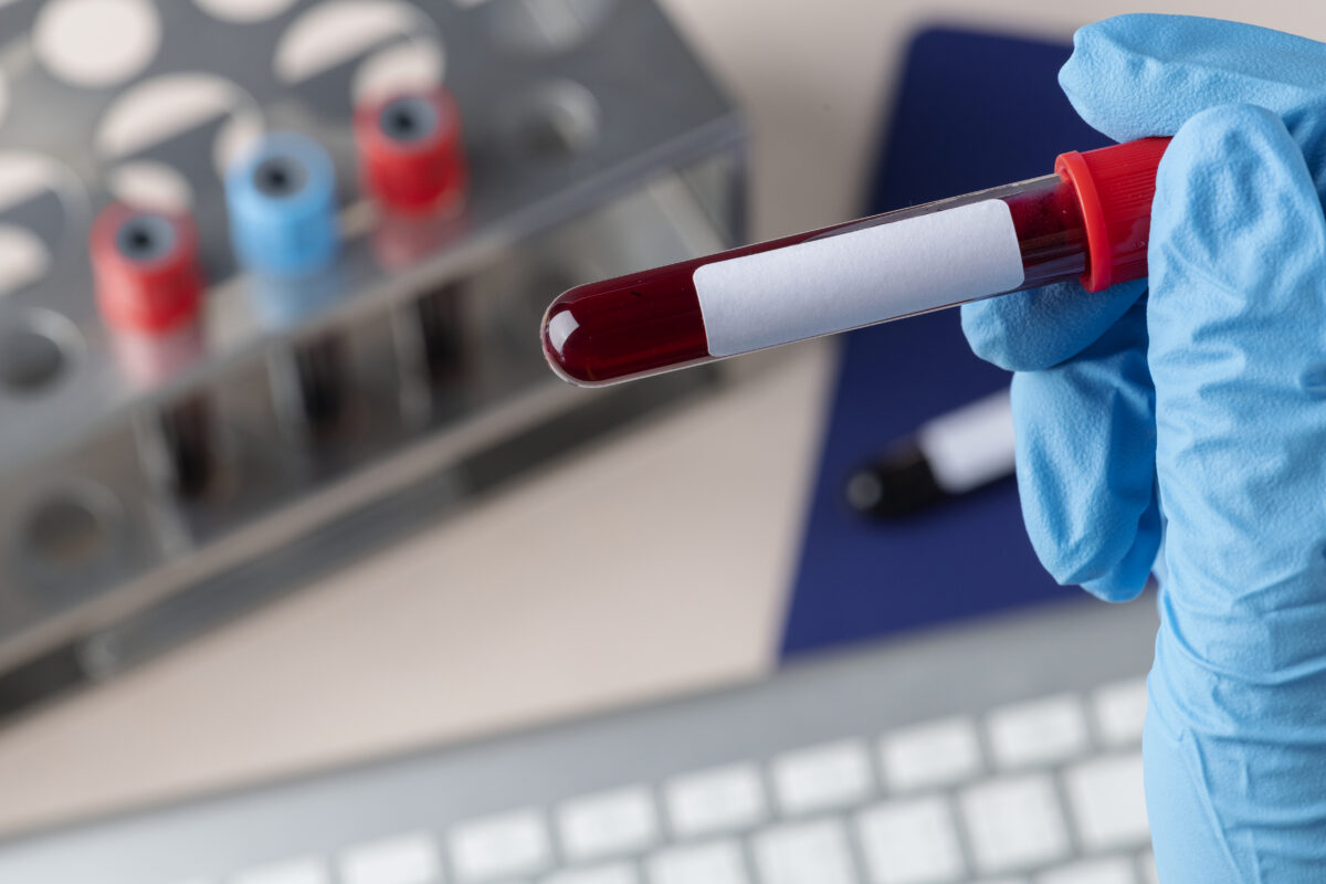 What Is Blood Routine Examination? Benefits, Test Details & Booking ...